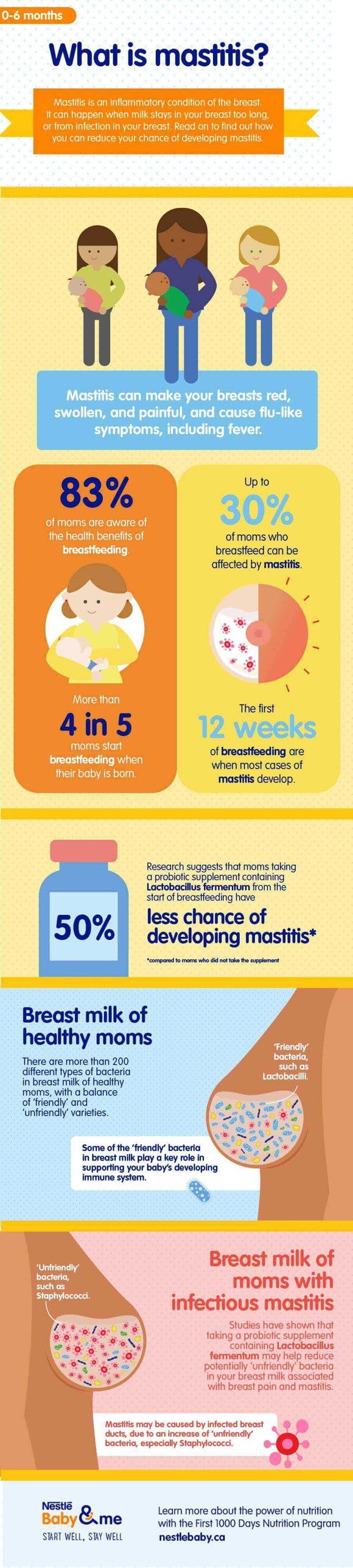 What is mastitis? | Learn More | Nestlé Baby & me