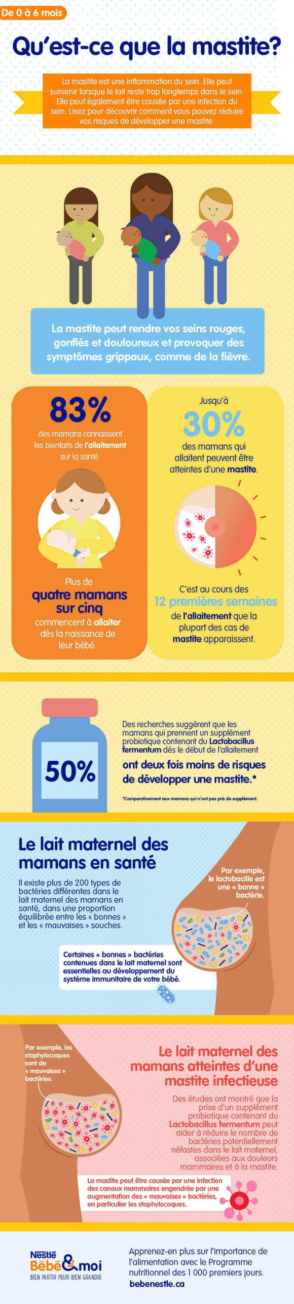 Qu’est-ce que la mastite? | Nestlé Bébé et moi